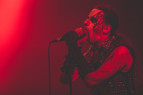 Akral Nekrosis in Bucharest on February 3, 2024 (4ae90079de) - Gigxels